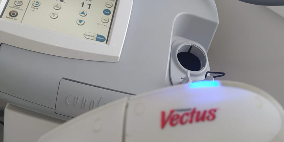 Depilacja laserowa Vectus – Look Ideal Kosmetologia